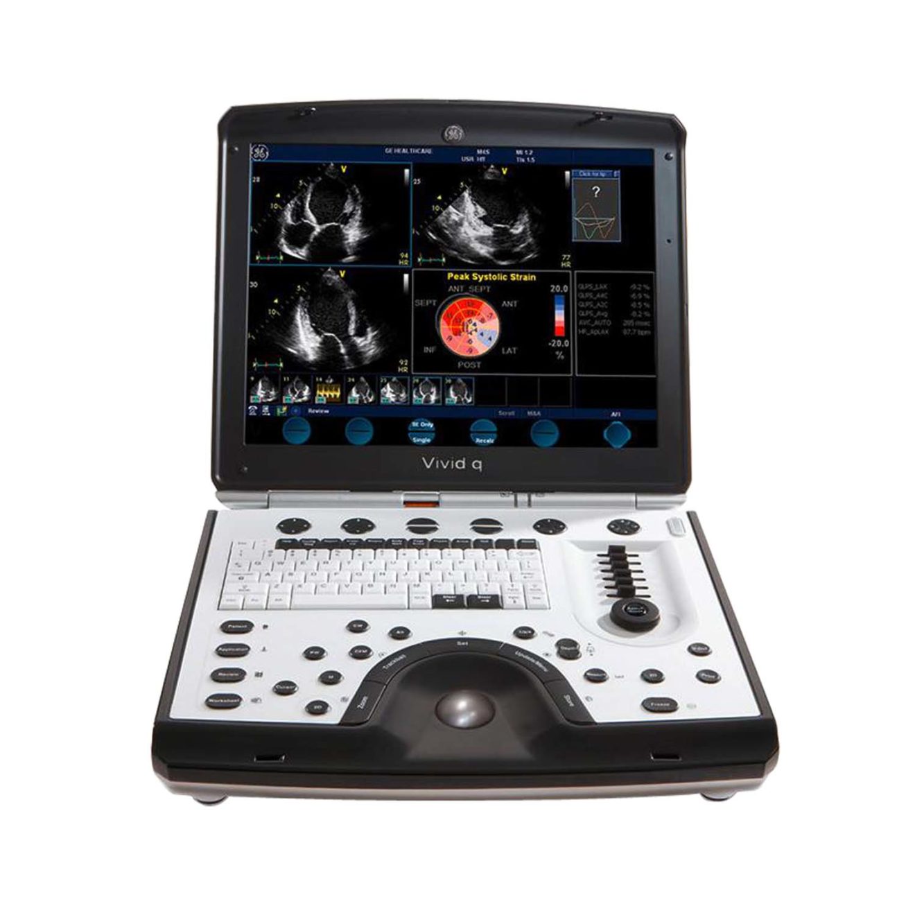 GE Vivid Q Cardiovascular Ultrasound System | planmedical